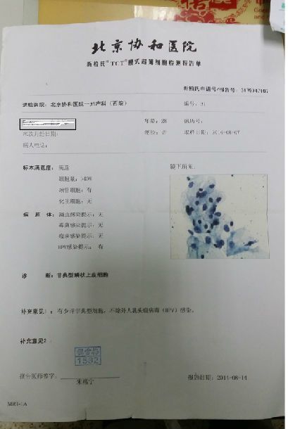Tct检查结果正常图宫颈癌确诊报告 伤感说说吧